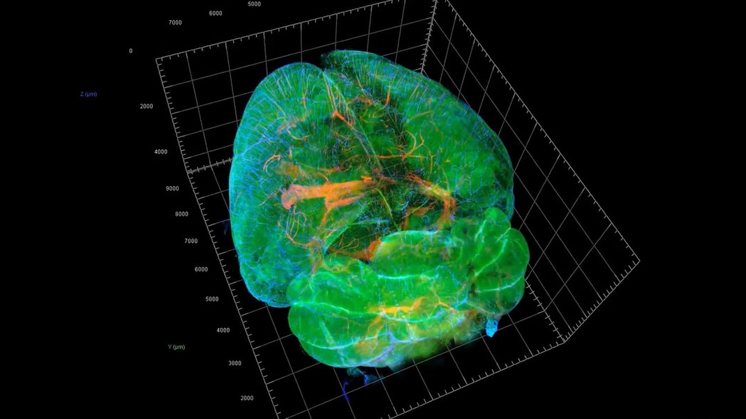 A game changer for neuroscience: Device will offer ultrafast real-time ...